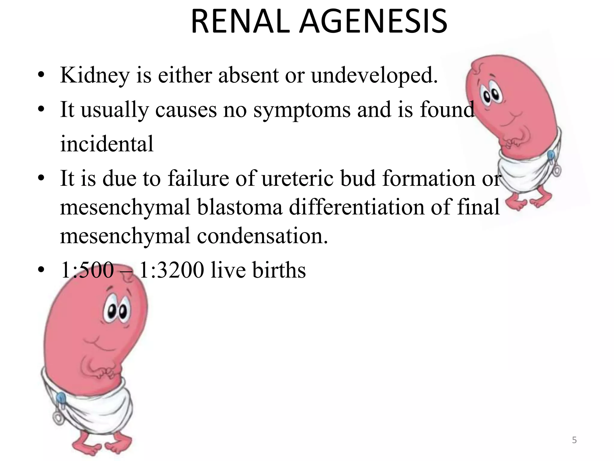 congenital anomalies of renal system | PPSX