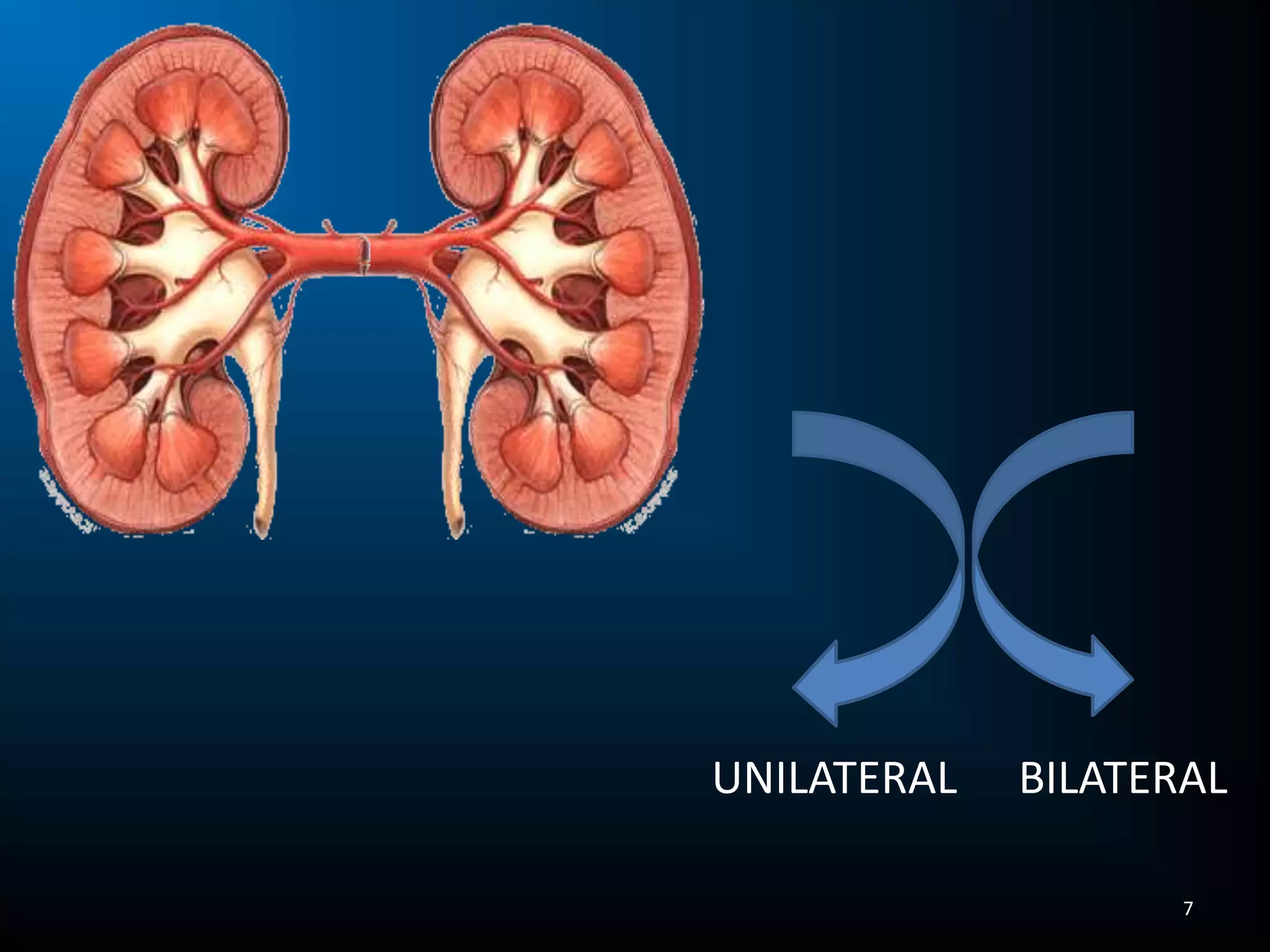 congenital anomalies of renal system | PPSX