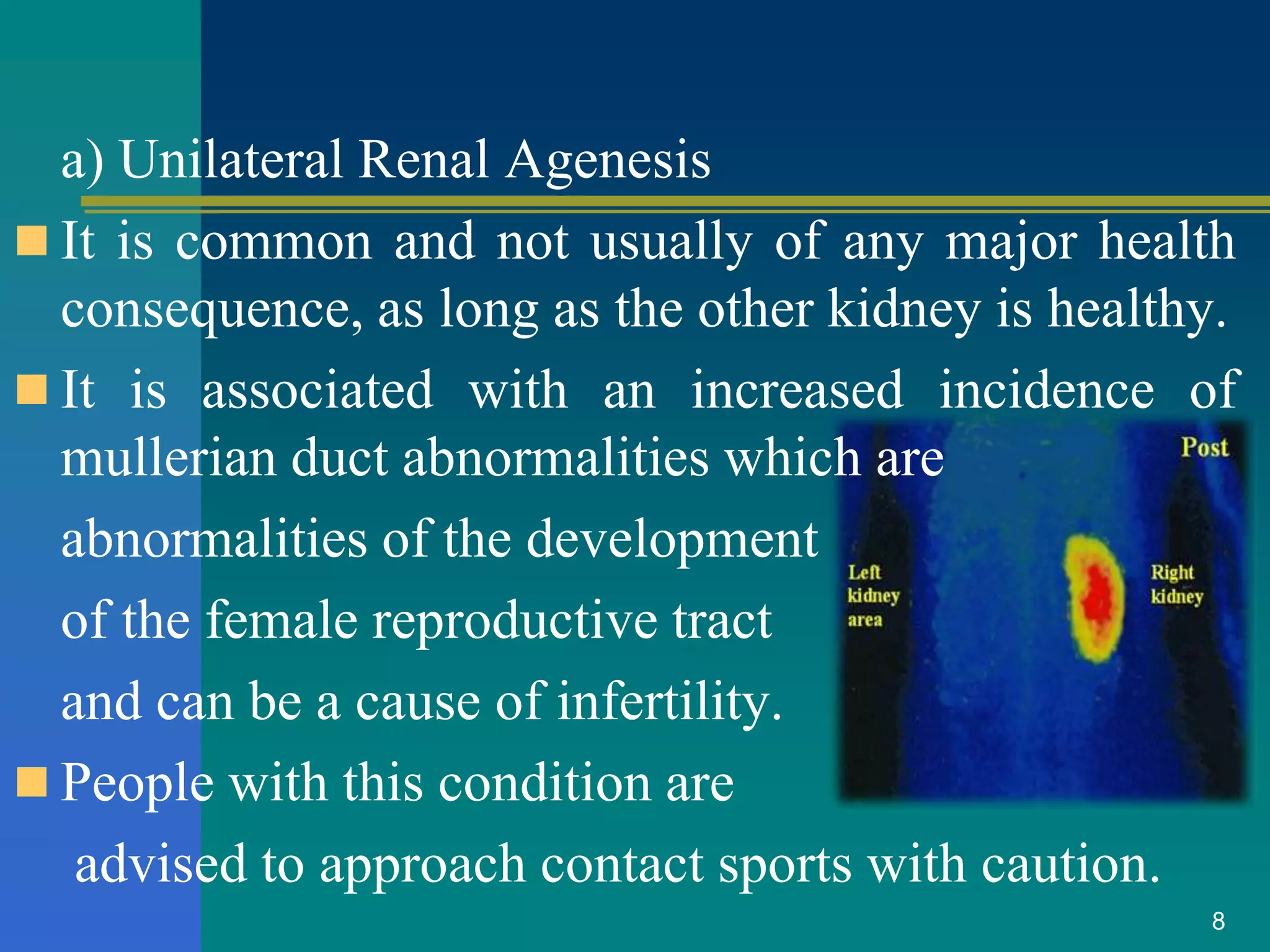 congenital anomalies of renal system | PPSX