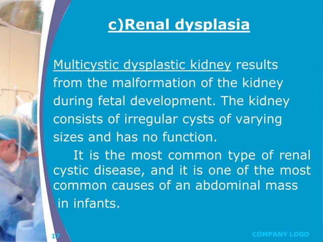 congenital anomalies of renal system | PPSX | Pregnancy | Reproductive ...