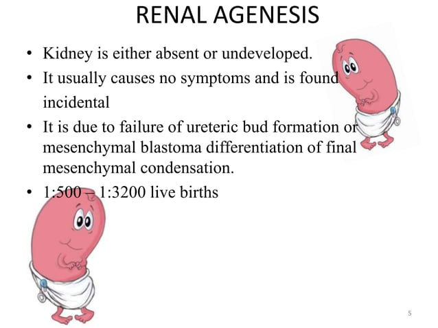 congenital anomalies of renal system | PPSX | Pregnancy | Reproductive ...