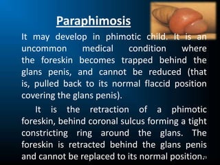 congenital anomalies of renal system | PPSX