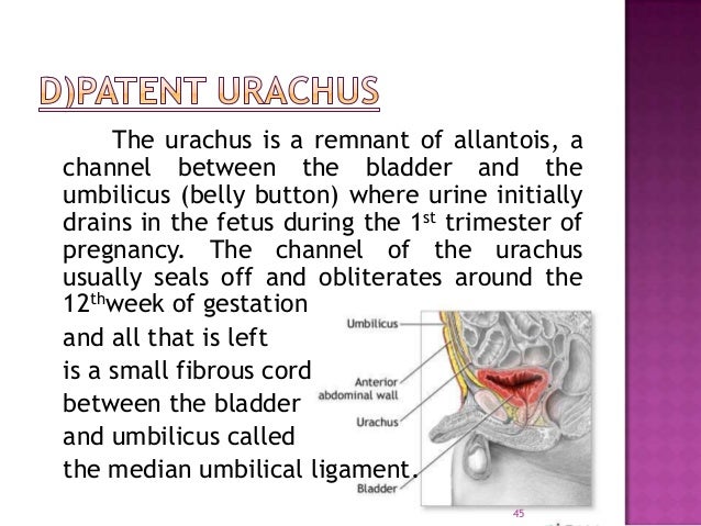 congenital anomalies of renal system