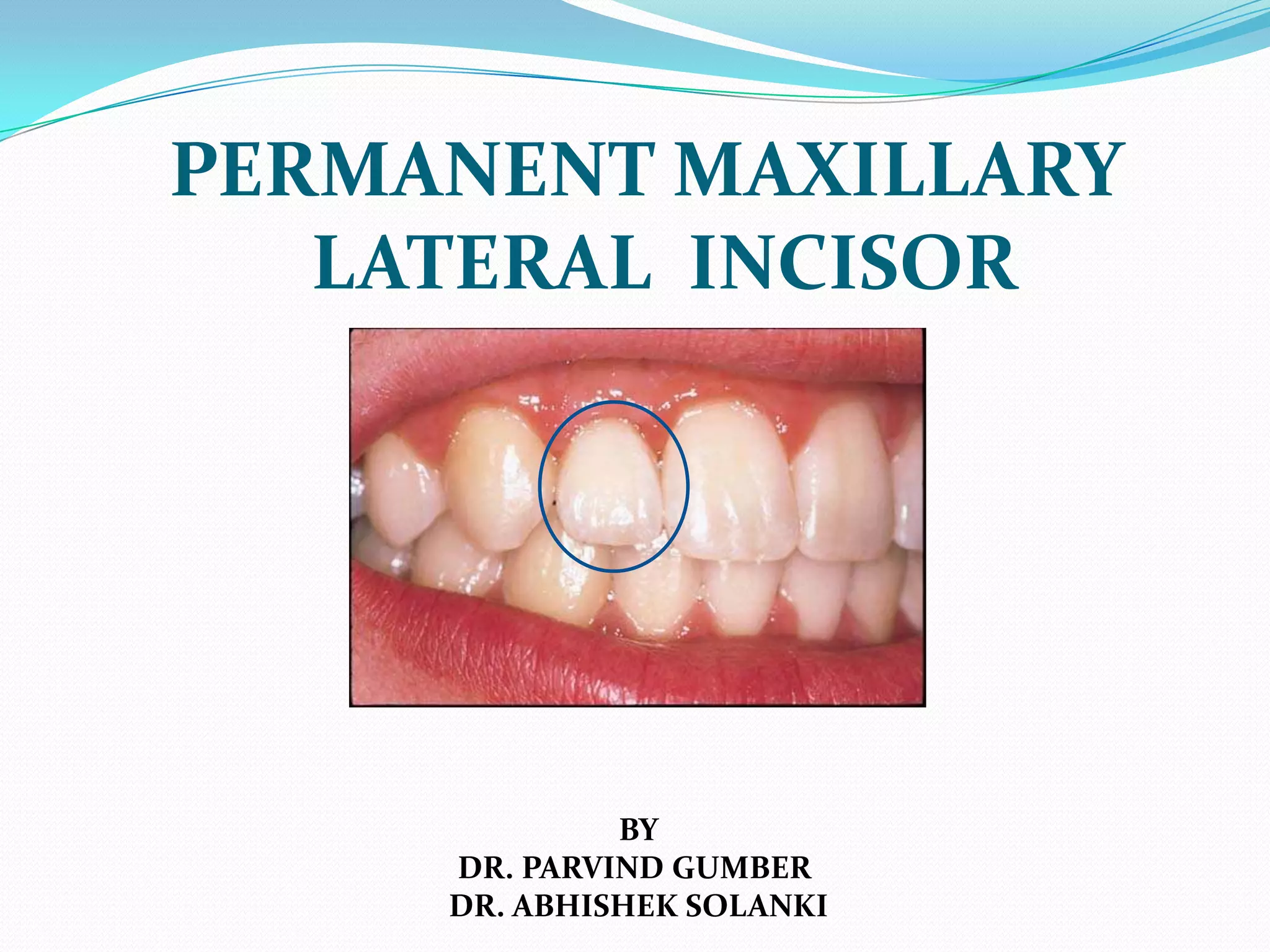 Permanant Maxillary Lateral Incisor | PPTX