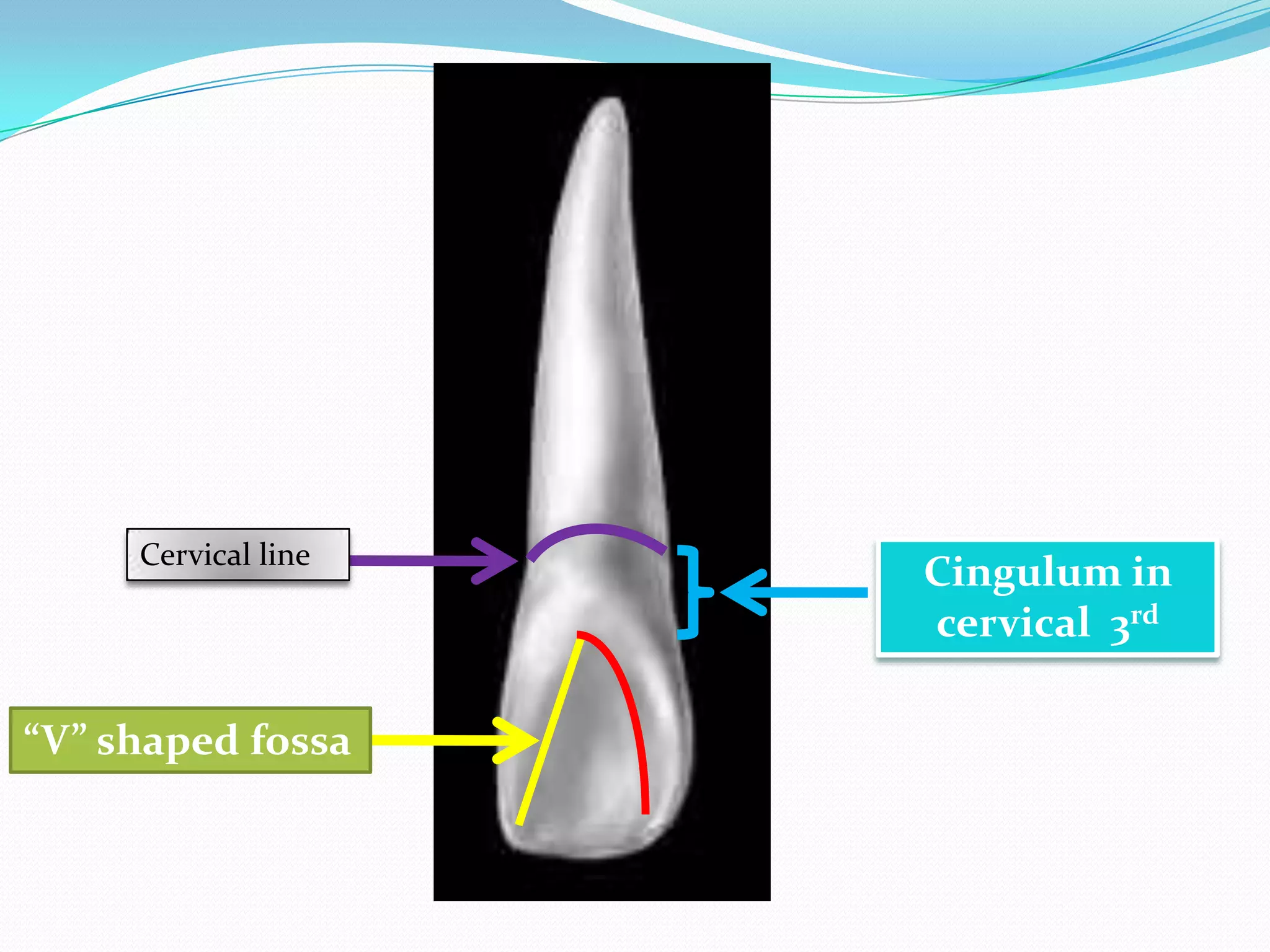 Permanant Maxillary Lateral Incisor | PPTX