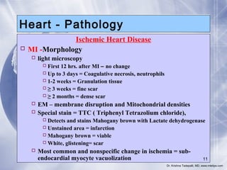 3. heart patghology; ischemic heart diseases | PPT