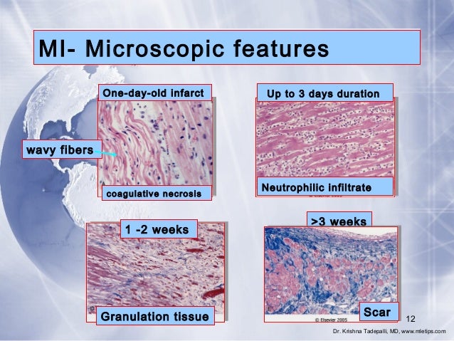 3. heart patghology; ischemic heart diseases