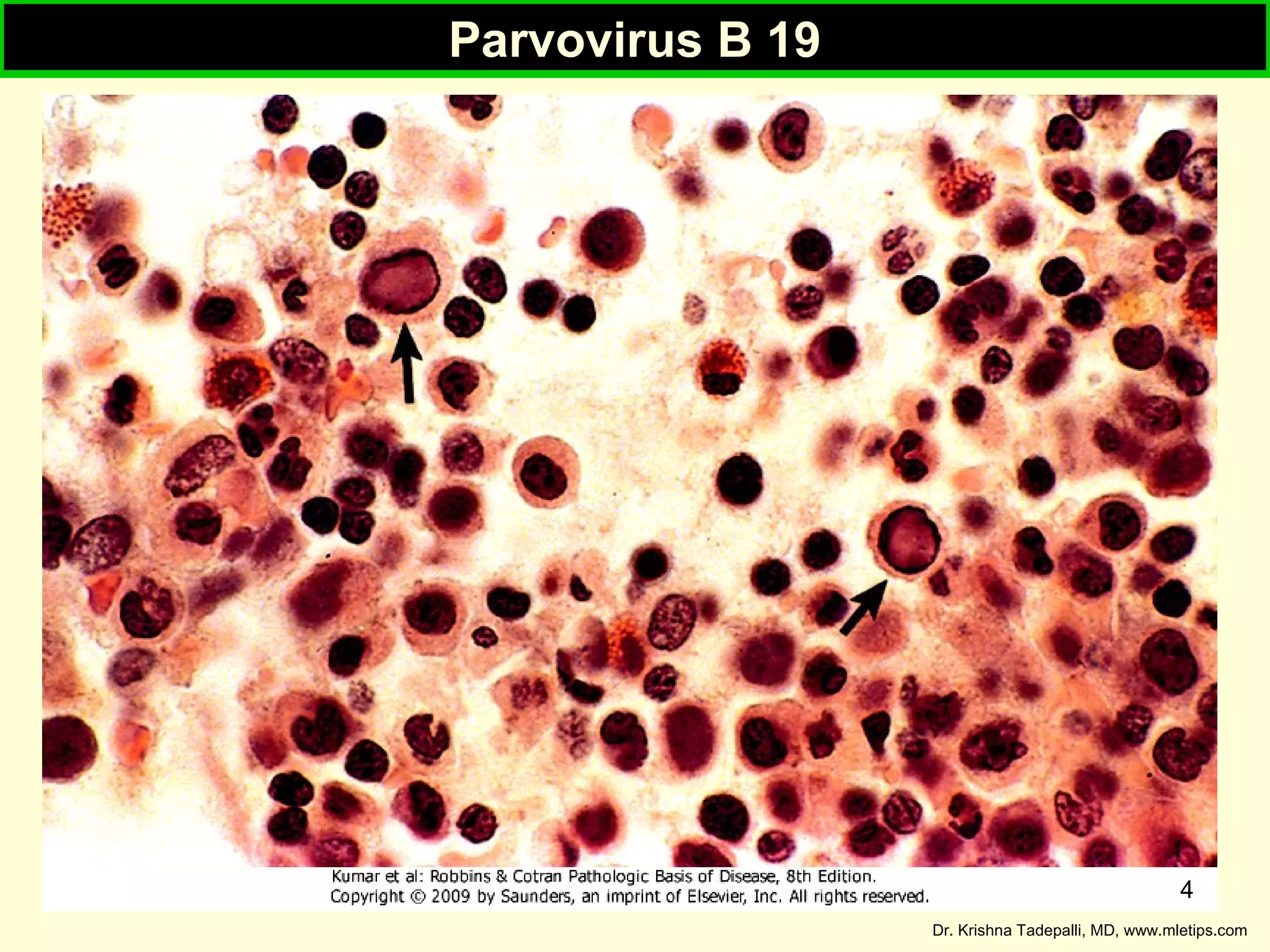 3. perinatal infections; pediatric pathology | PPT
