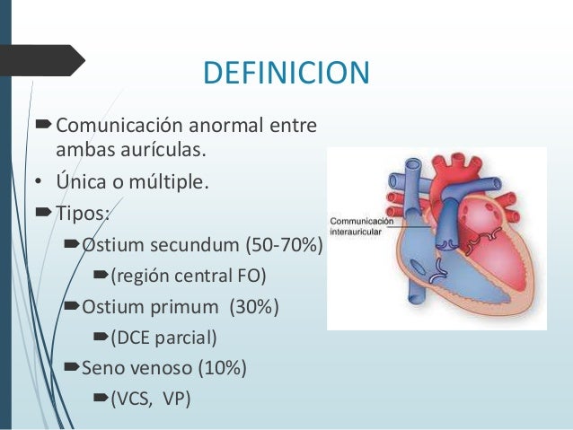 Comunicacin Interauricular Wikipedia La Enciclopedia Libre