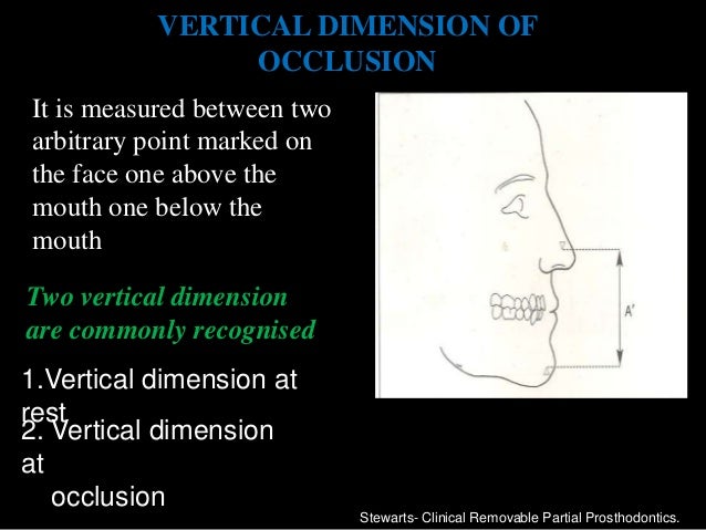 3.jaw relation and occ in rpd