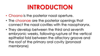 3. choanal atresia | PPTX