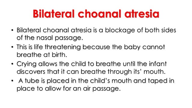 3. choanal atresia