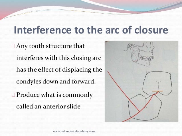full mouth rehabilitation/ academy general dentistry
