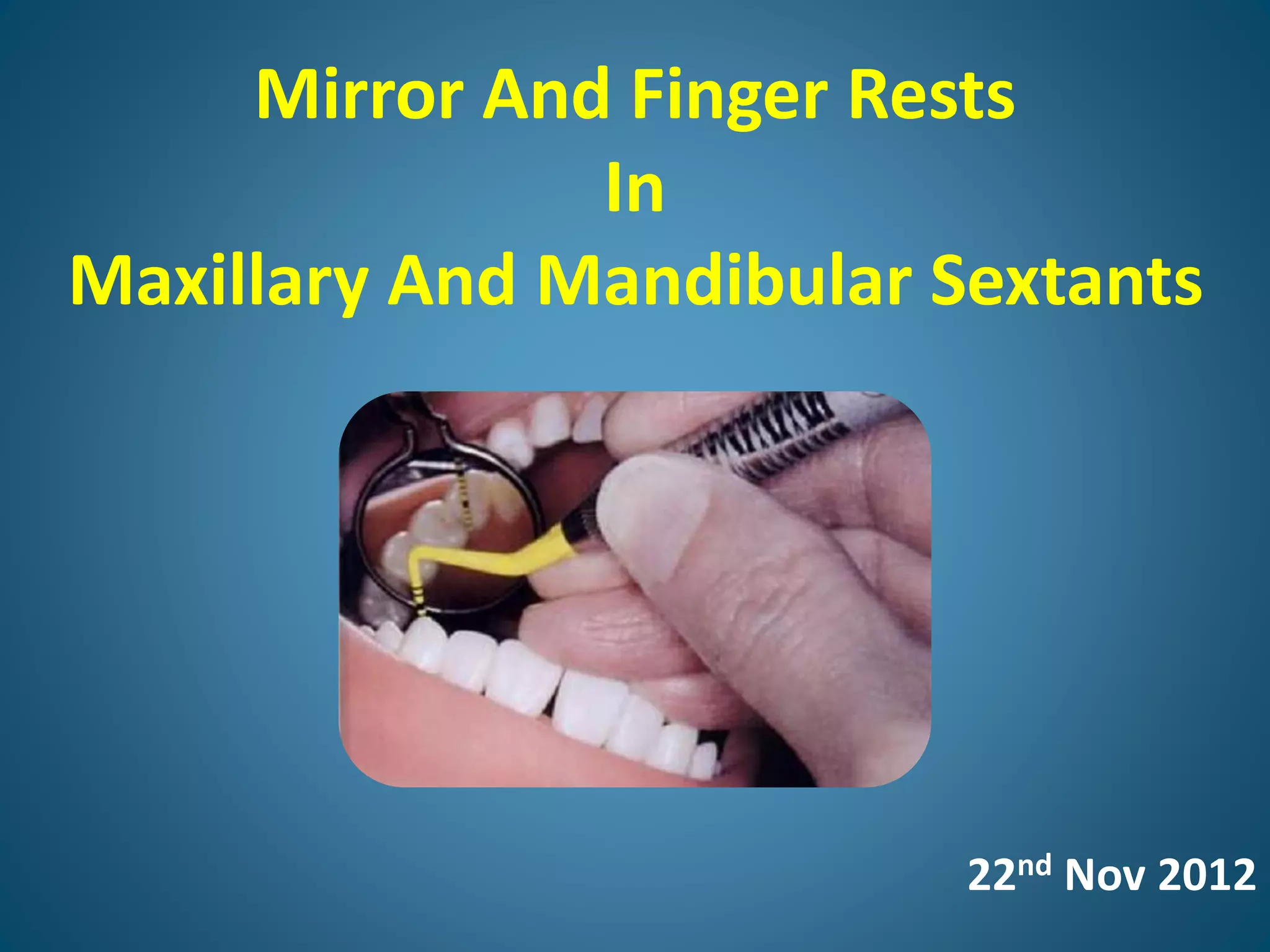 Periodontics - Mirror and Finger rests | PPTX