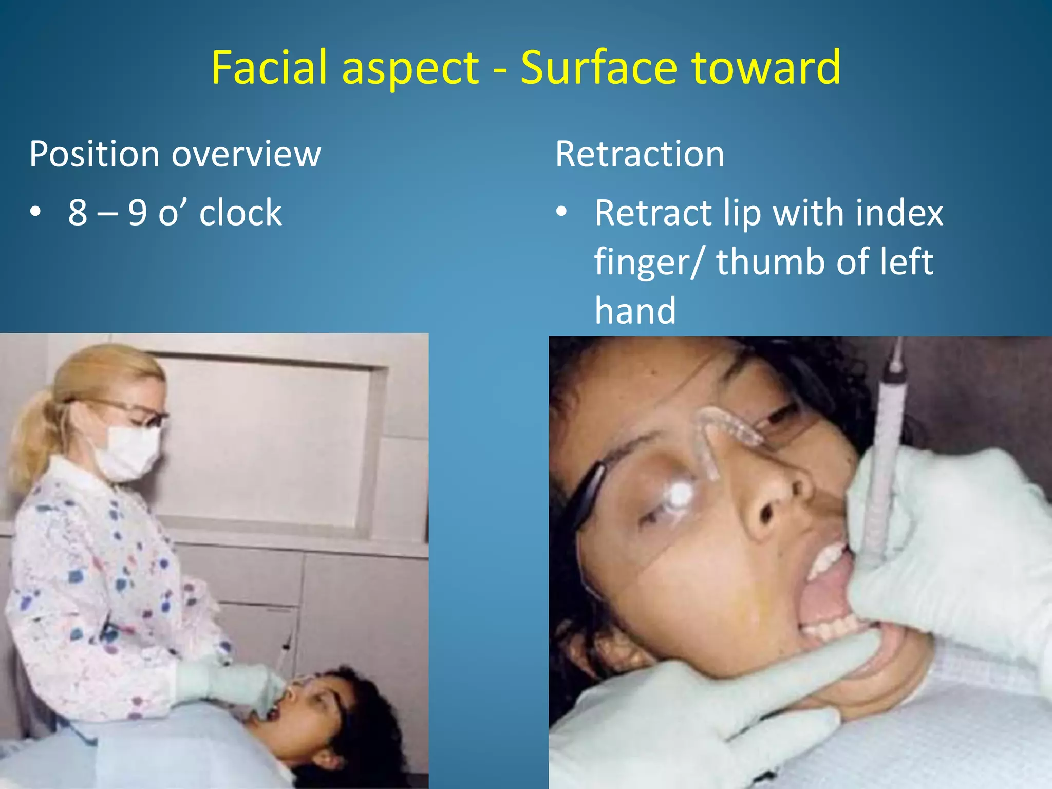 Periodontics - Mirror and Finger rests | PPTX