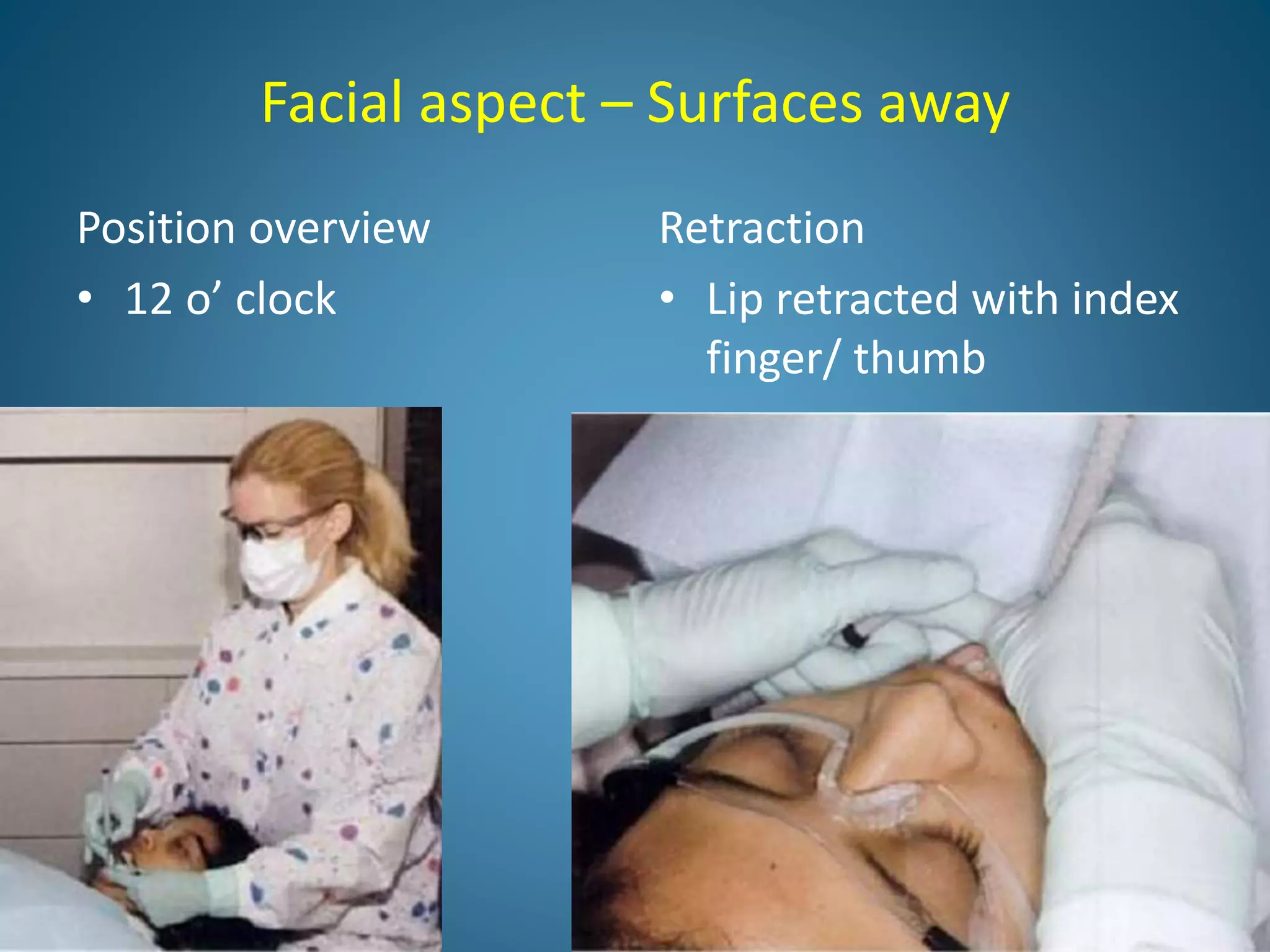 Periodontics - Mirror and Finger rests | PPTX