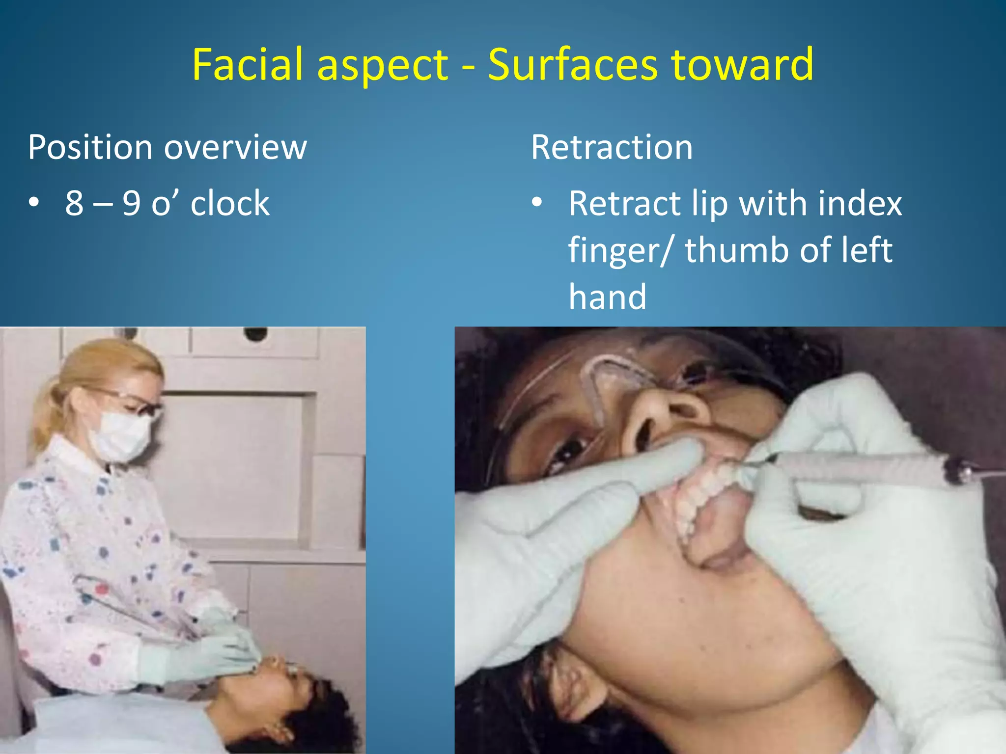 Periodontics - Mirror and Finger rests | PPTX