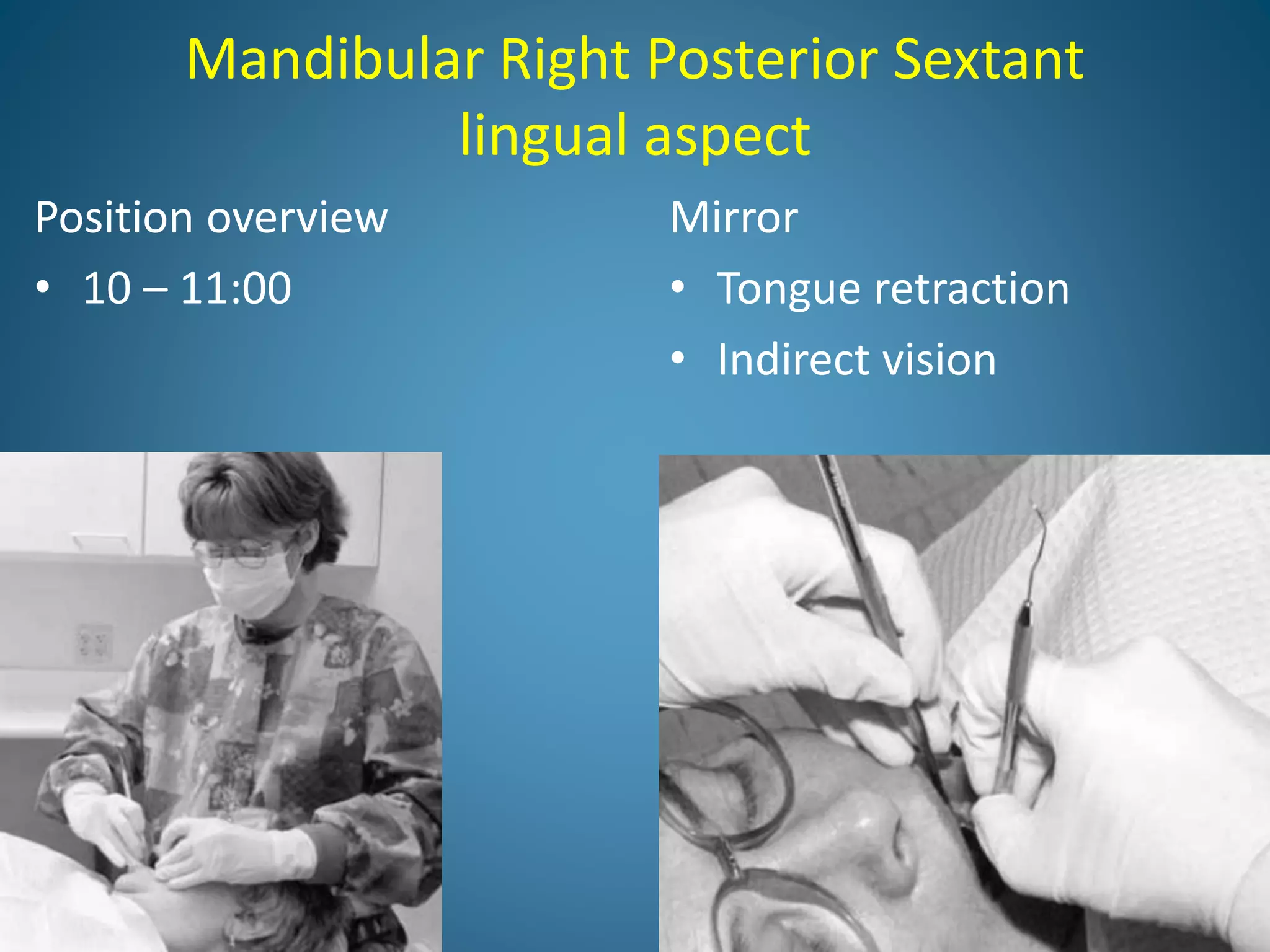 Periodontics - Mirror and Finger rests | PPTX