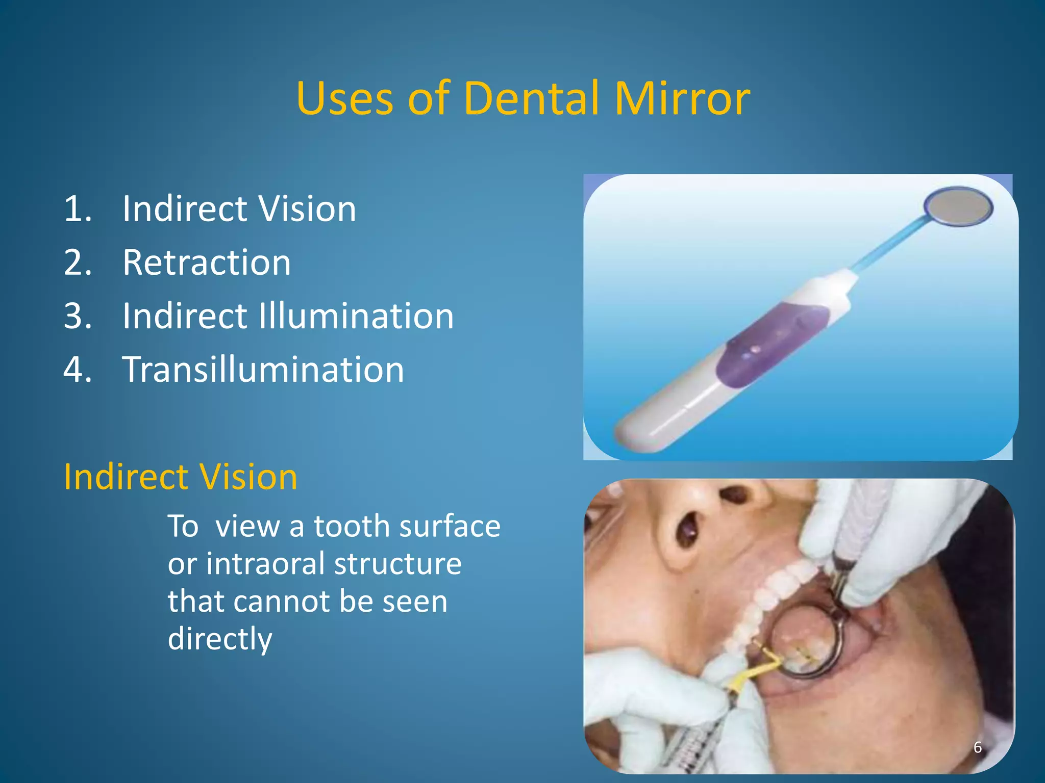 Periodontics - Mirror and Finger rests | PPTX
