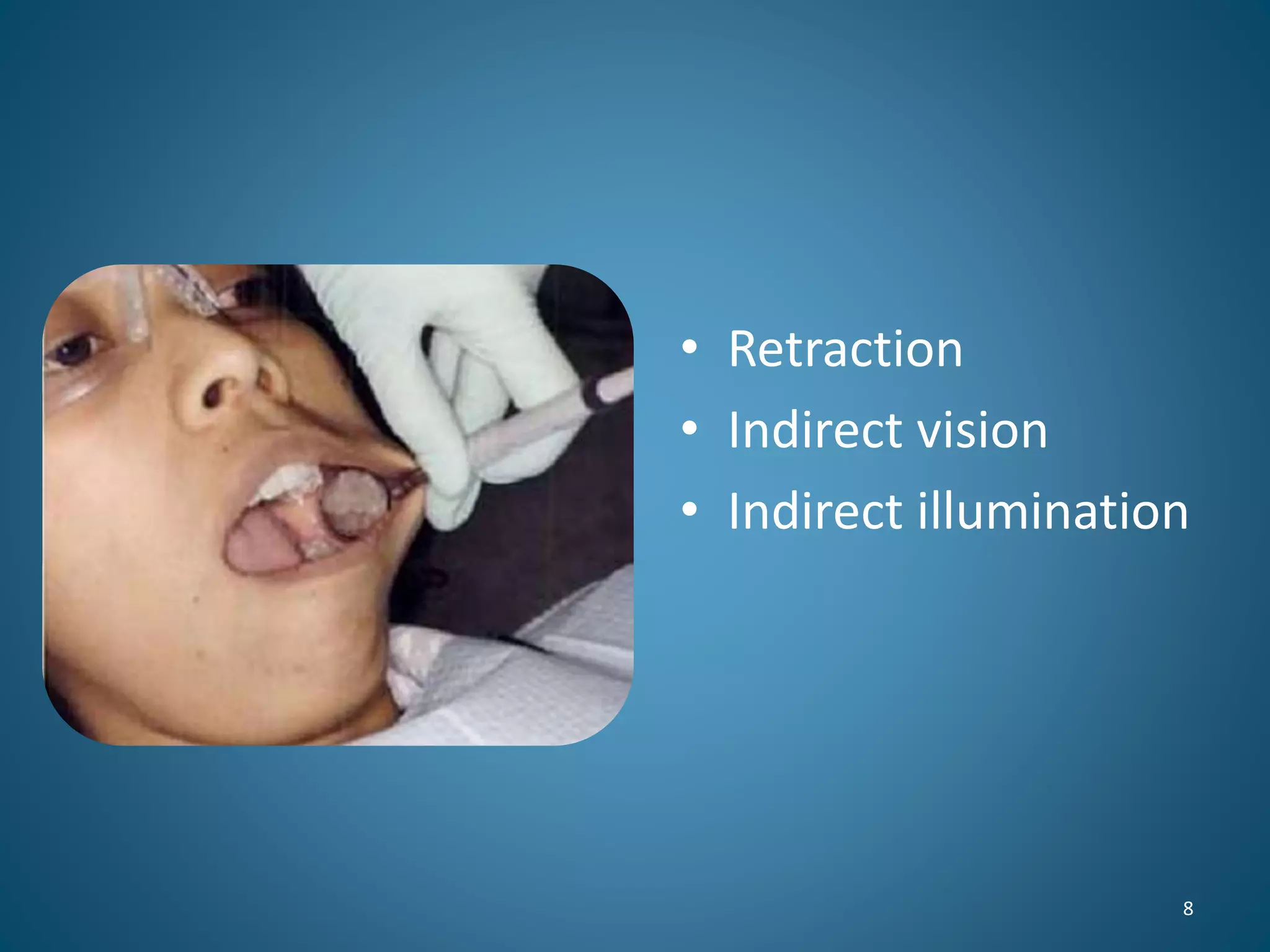 Periodontics - Mirror and Finger rests | PPTX