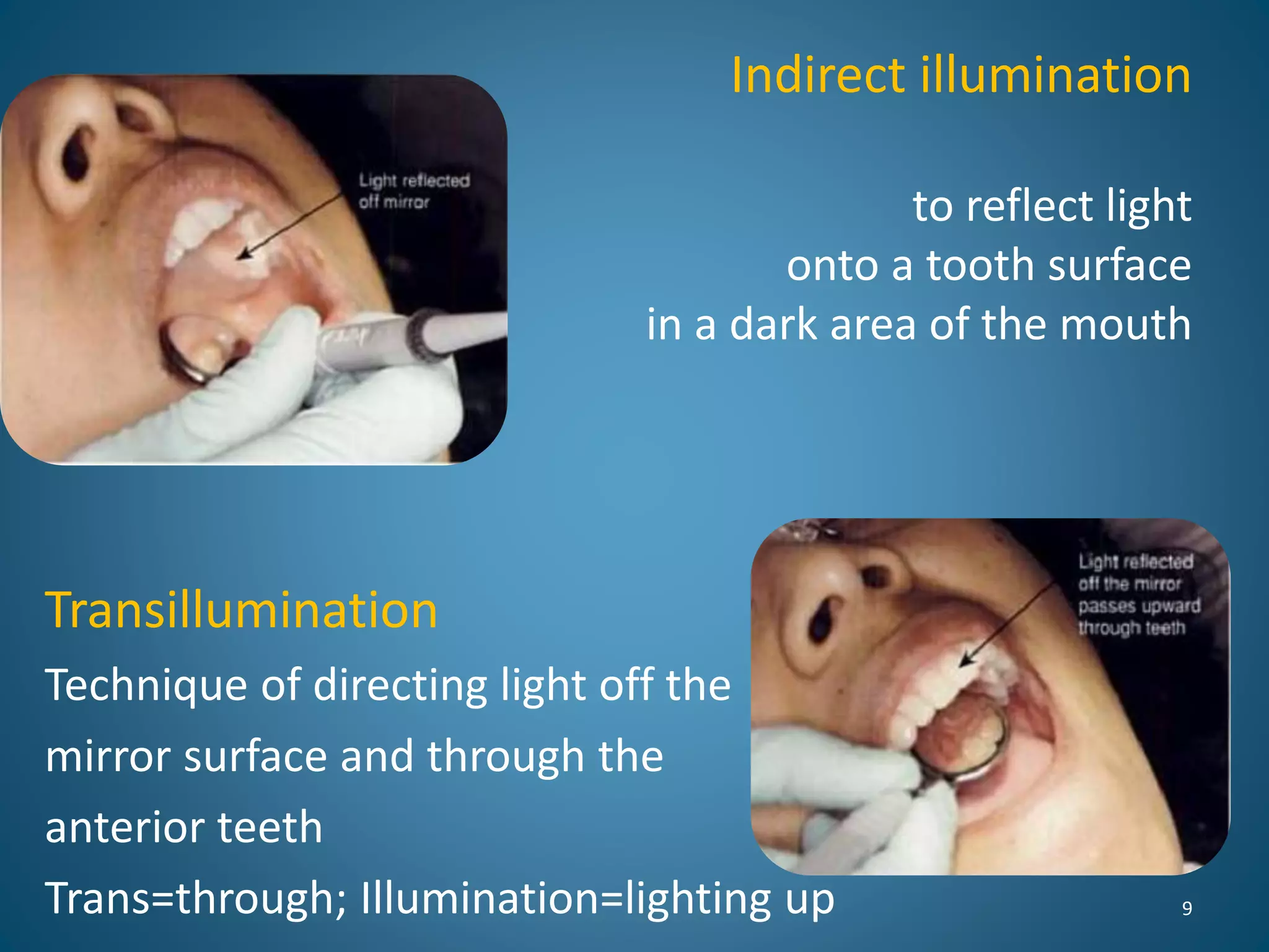 Periodontics - Mirror and Finger rests | PPTX