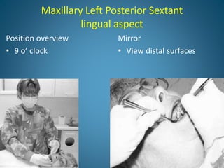Periodontics - Mirror and Finger rests | PPTX