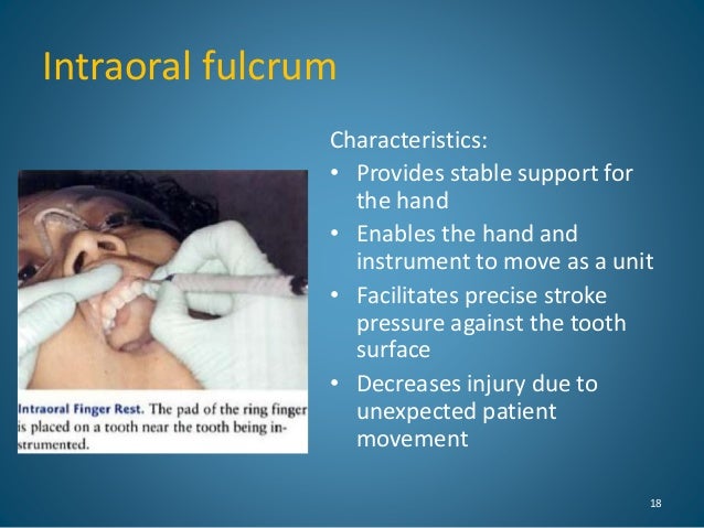 Periodontics - Mirror and Finger rests