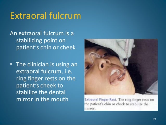 Periodontics - Mirror and Finger rests