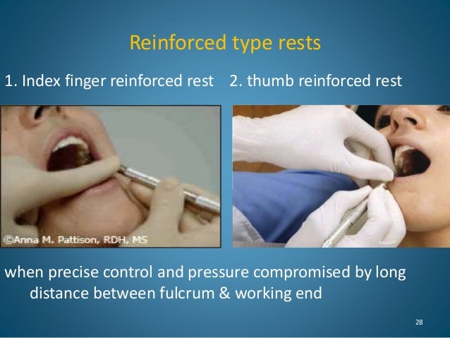 Periodontics - Mirror and Finger rests