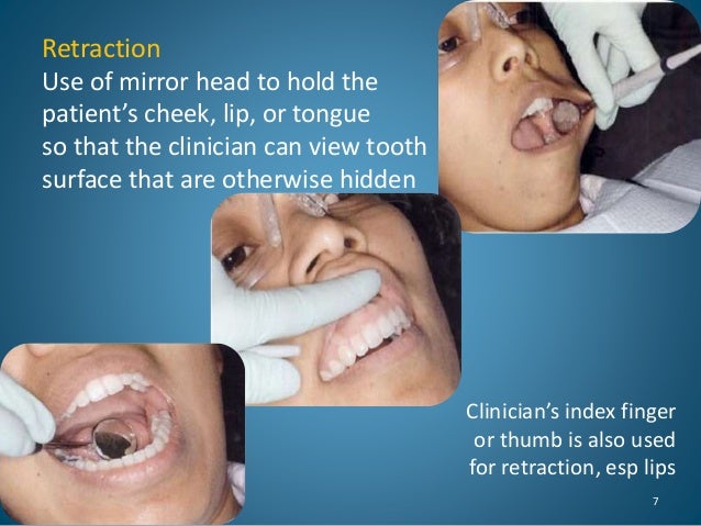Periodontics - Mirror and Finger rests