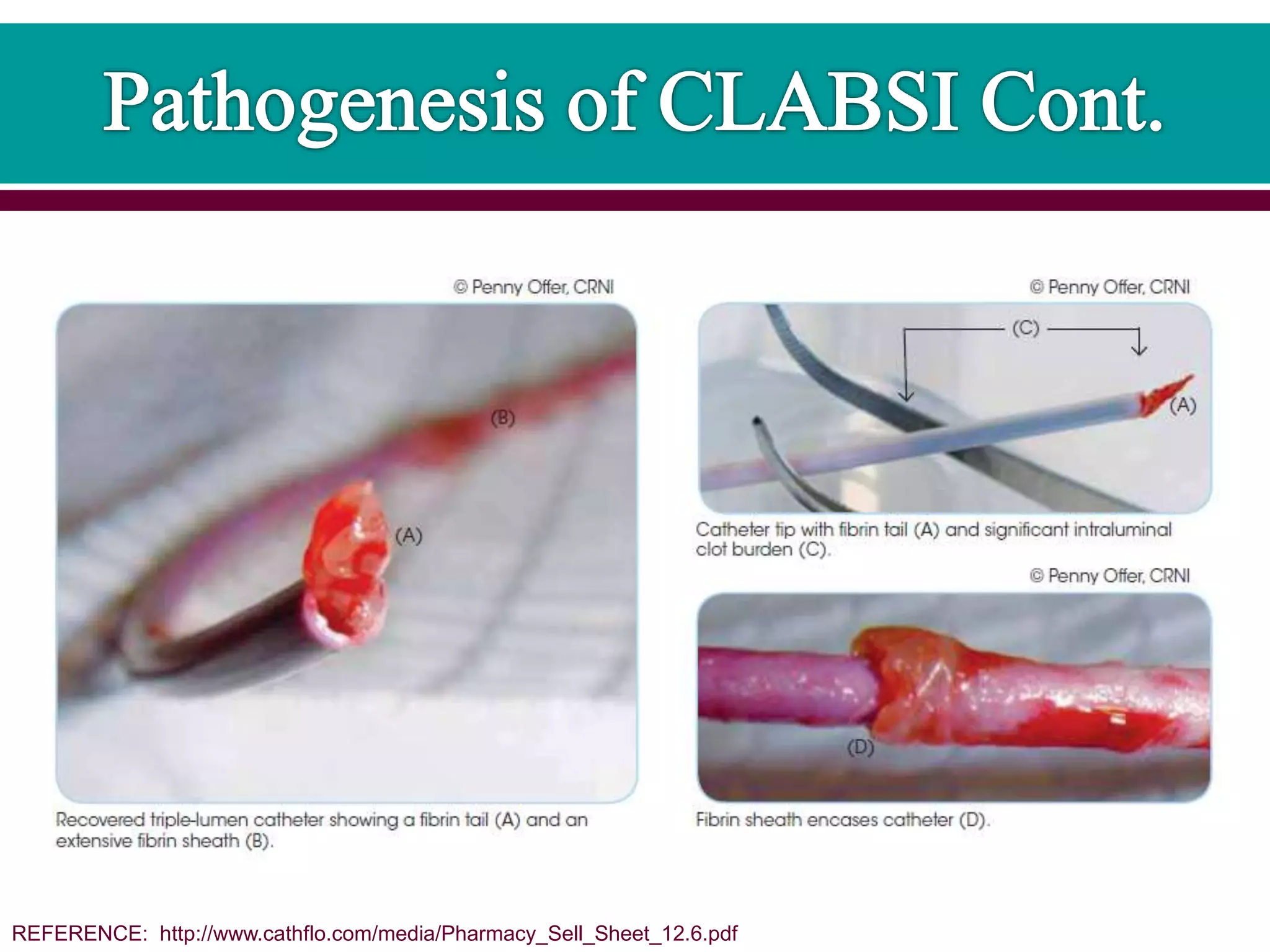 3. central line associated blood stream infection | PPTX