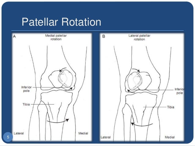 3. biomechanics of Patellofemoral joint