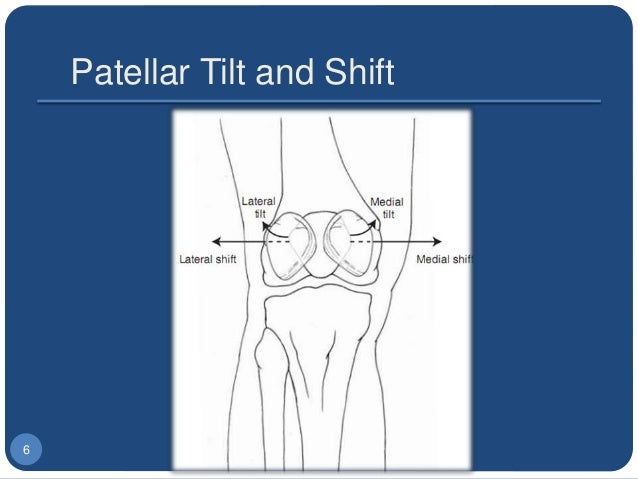 3. biomechanics of Patellofemoral joint