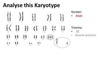 IB Biology 3.2 Slides: Chromosomes | PPTX