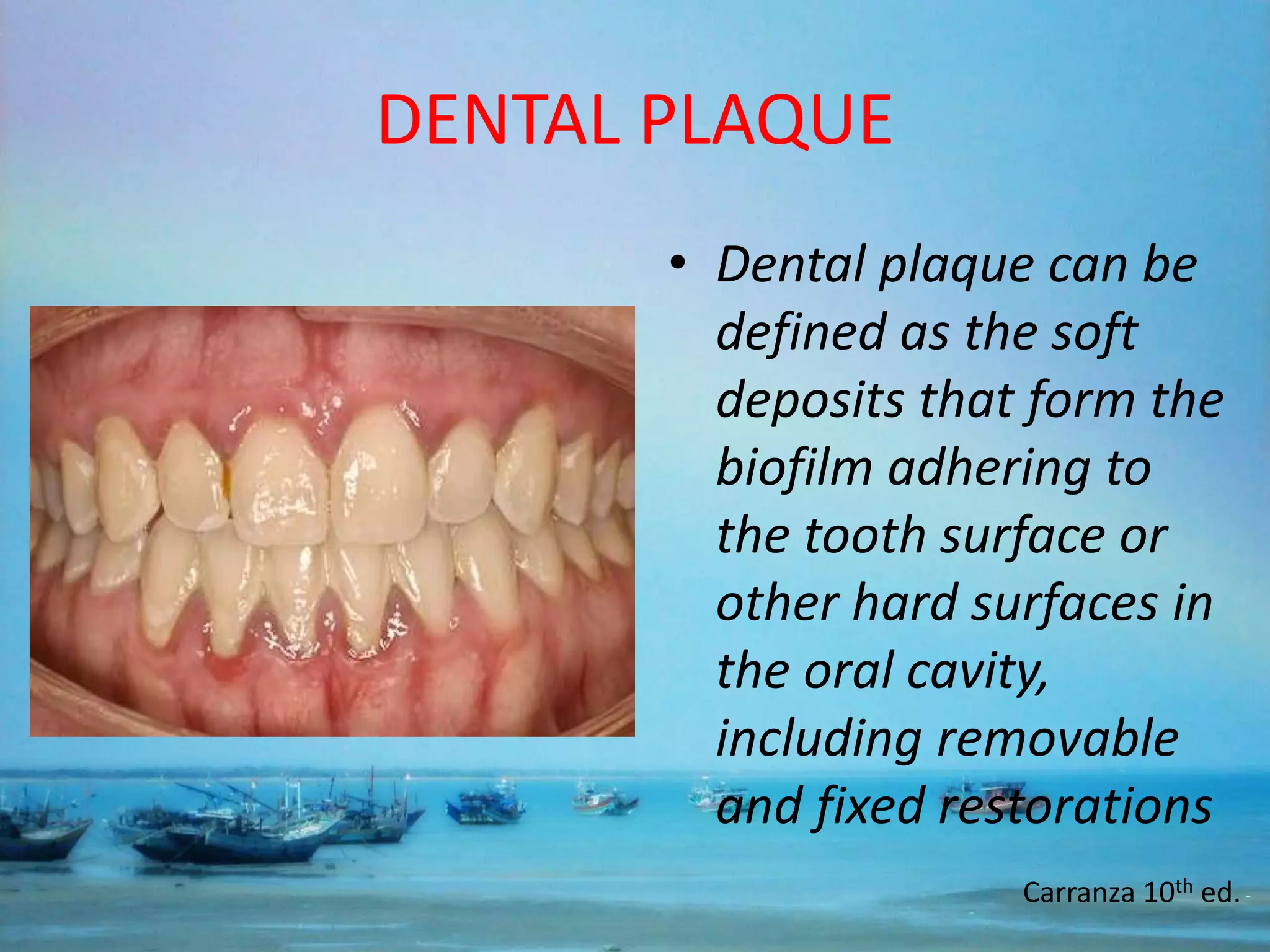 Dental Biofilm | PPTX