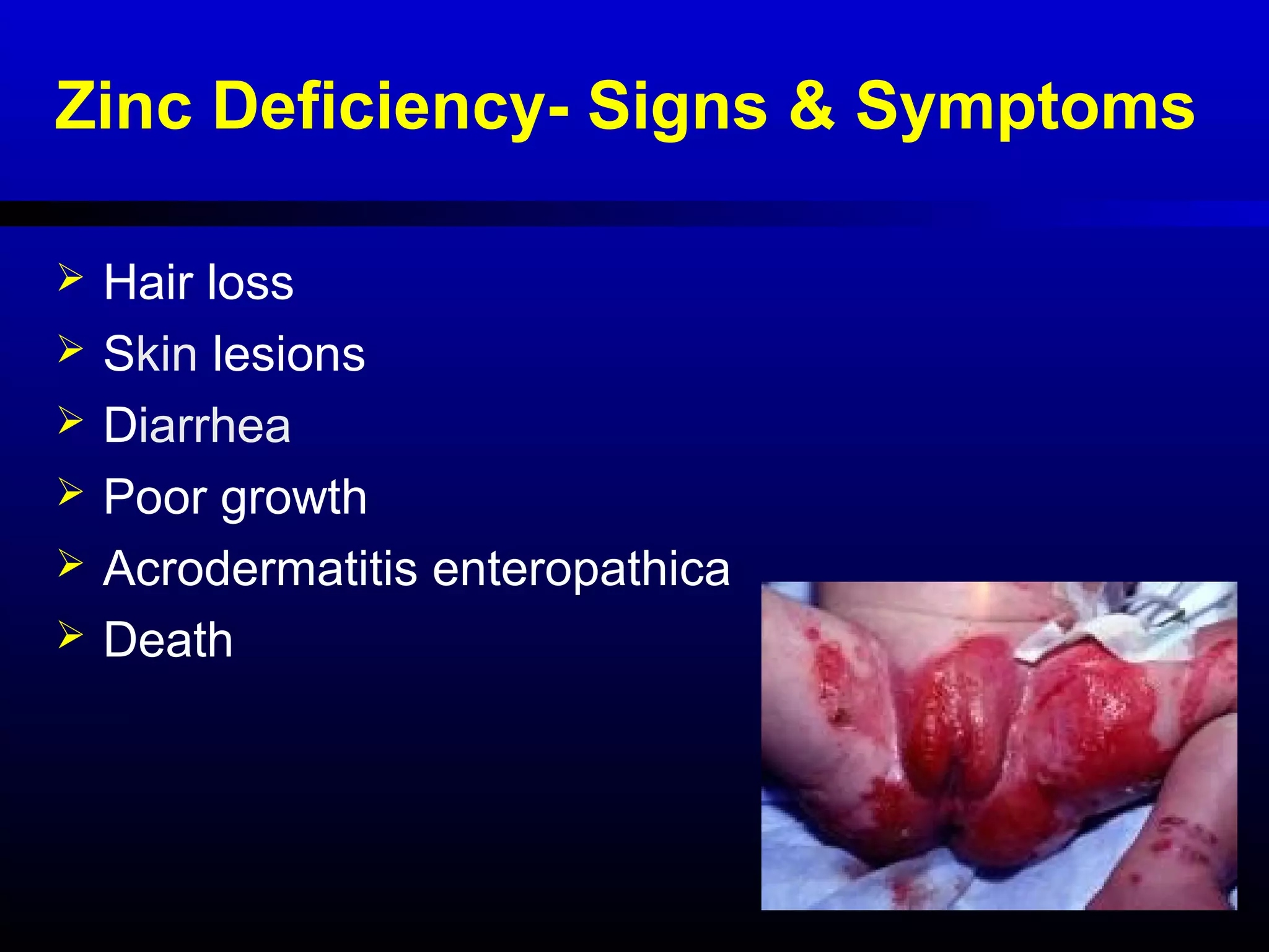 3.indicators clinical-tools-overview of-micronutrient_deficiency ...