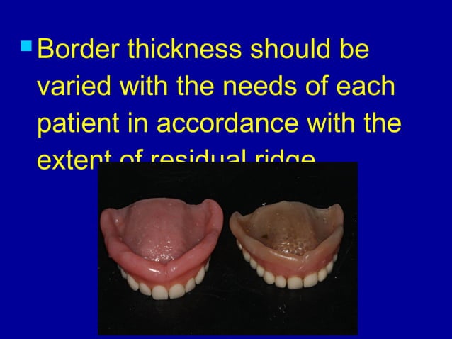 stock trays & diagnostic casts | PPT