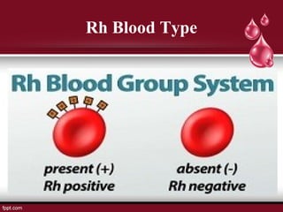 Blood Types, Transfusion & Organ Transplantation | PPT