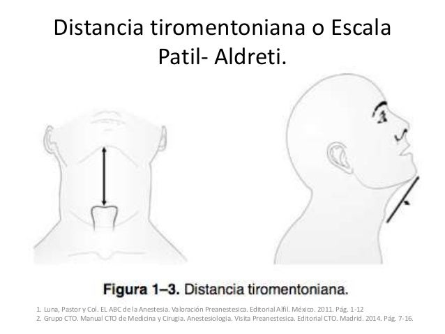 3. VALORACIÓN PREANESTESICA