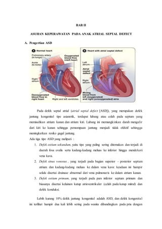 ASKEP ATRIAL SEPTAL DEFECT (ASD) | DOCX