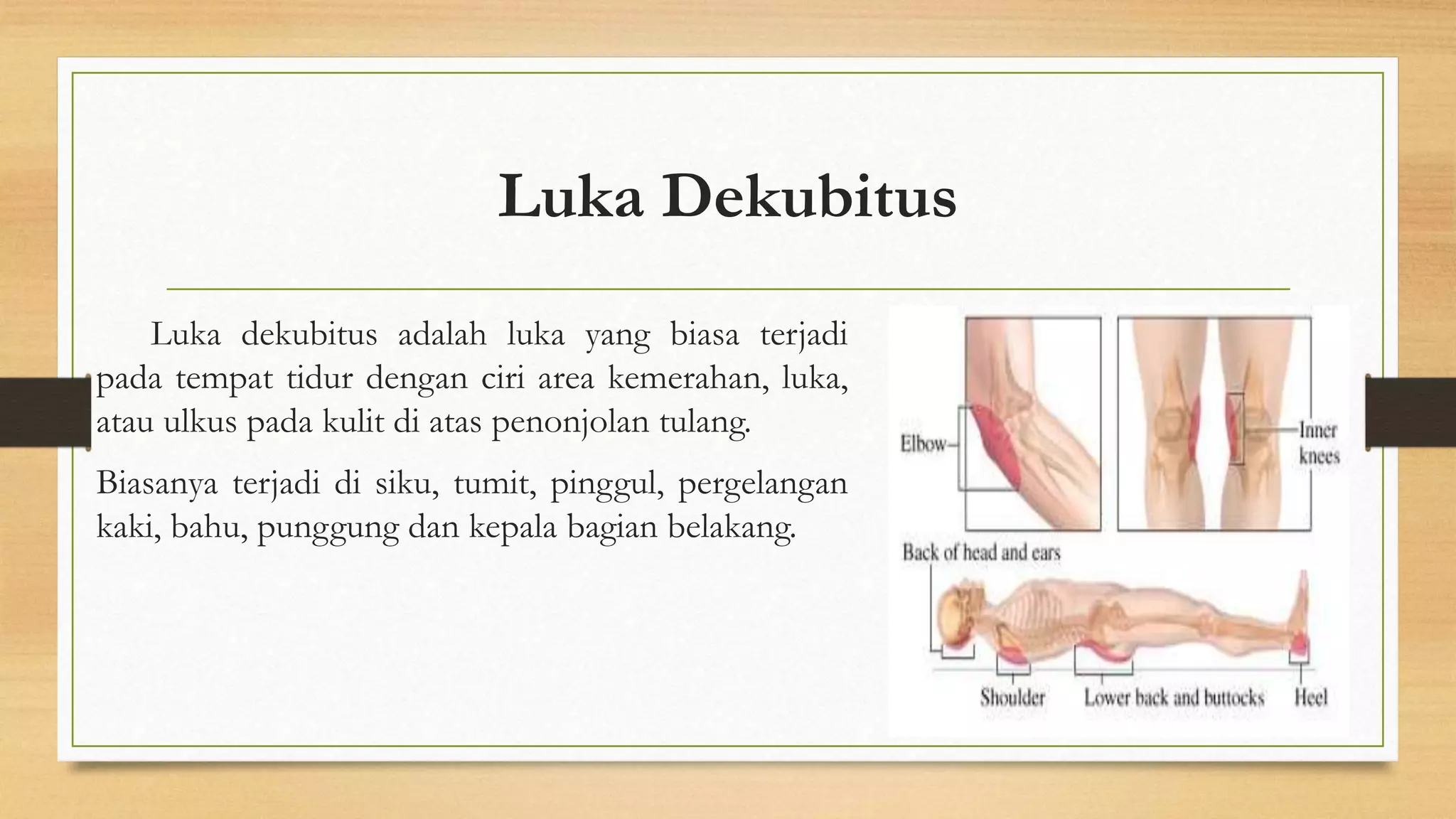 Konsep Perawatan Luka Dekubitus dan Gangrene | PPTX
