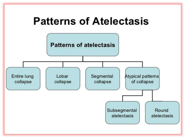 atelectasis | PPTX | Lung and Respiratory Health | Diseases and Conditions