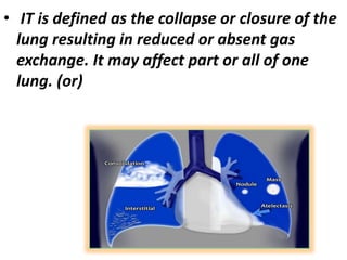 atelectasis | PPTX | Lung and Respiratory Health | Diseases and Conditions