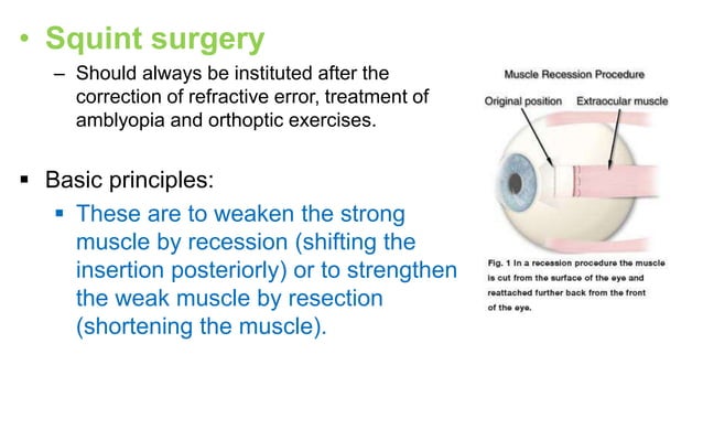 concomitant strabismus | PPTX | Eye and Vision Conditions | Diseases ...