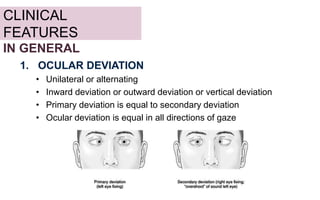 concomitant strabismus | PPTX