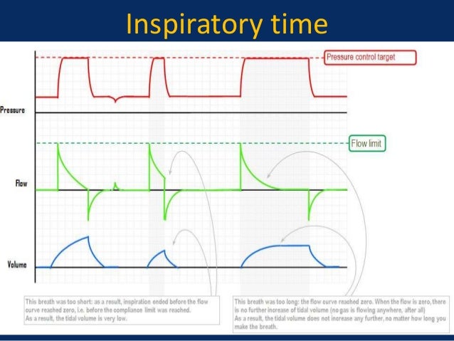 3. ventilatory setting