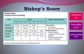 Medical induction of labour | PPTX