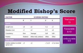 Medical induction of labour | PPTX