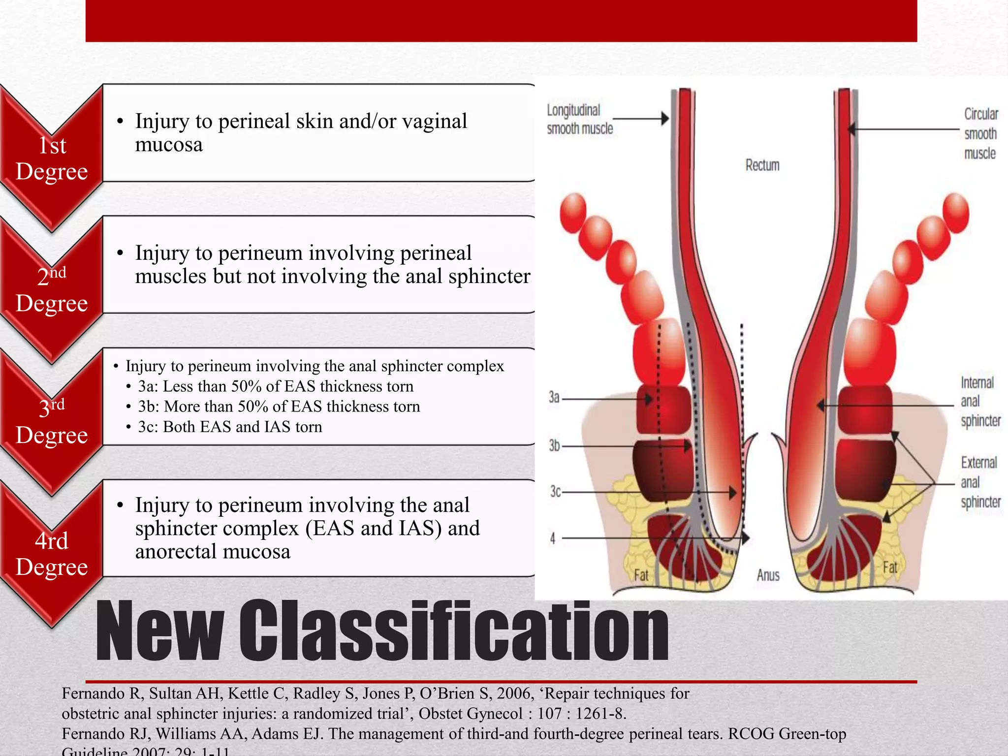 Steps of Repairing Total Perineal Rupture: Evidenced-based | PDF