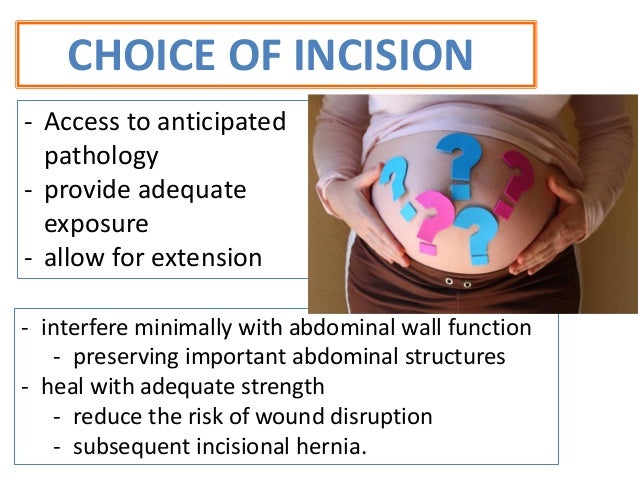 Modern Approach to The Cesarean Section Technique